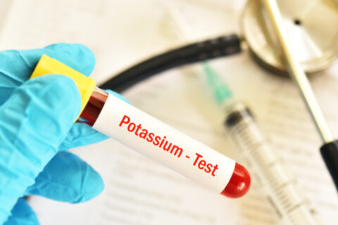 Hyperkalemia Treatment in Arizona | High Potassium Specialist
